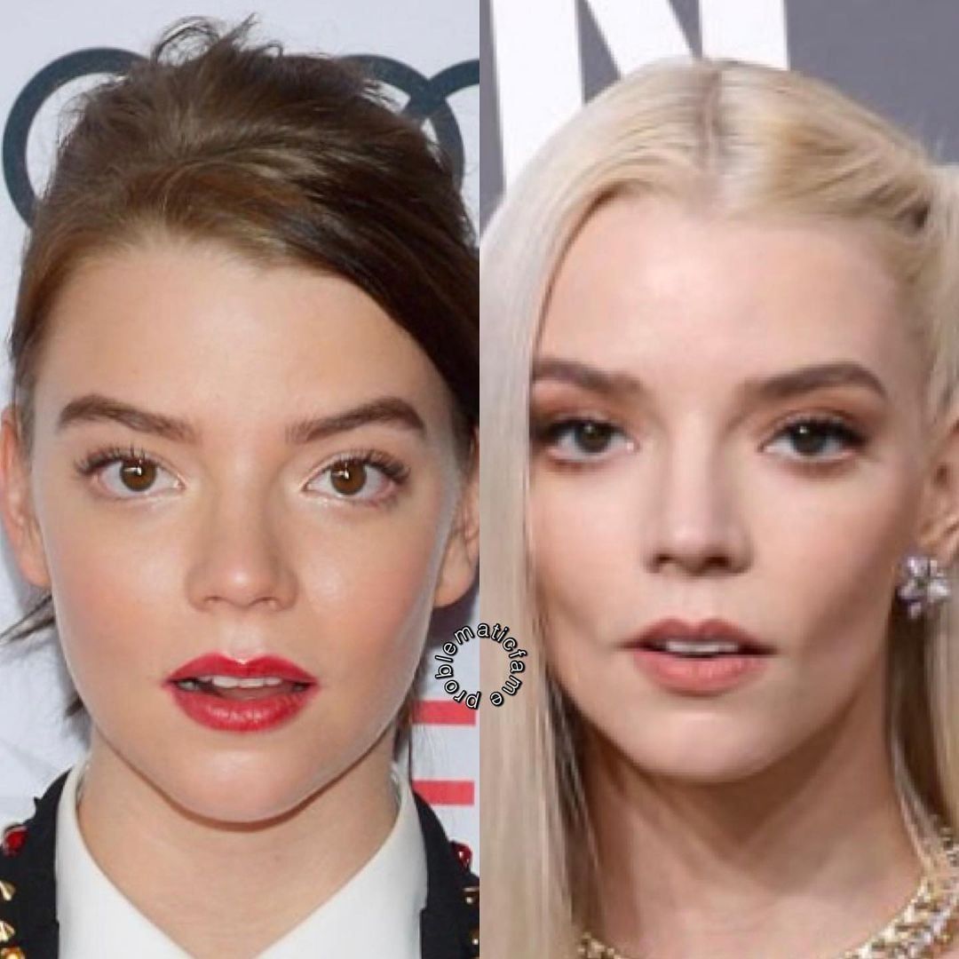 Así se veía Anya Taylor-Joy antes de sus cirugías estéticas: parecía ...