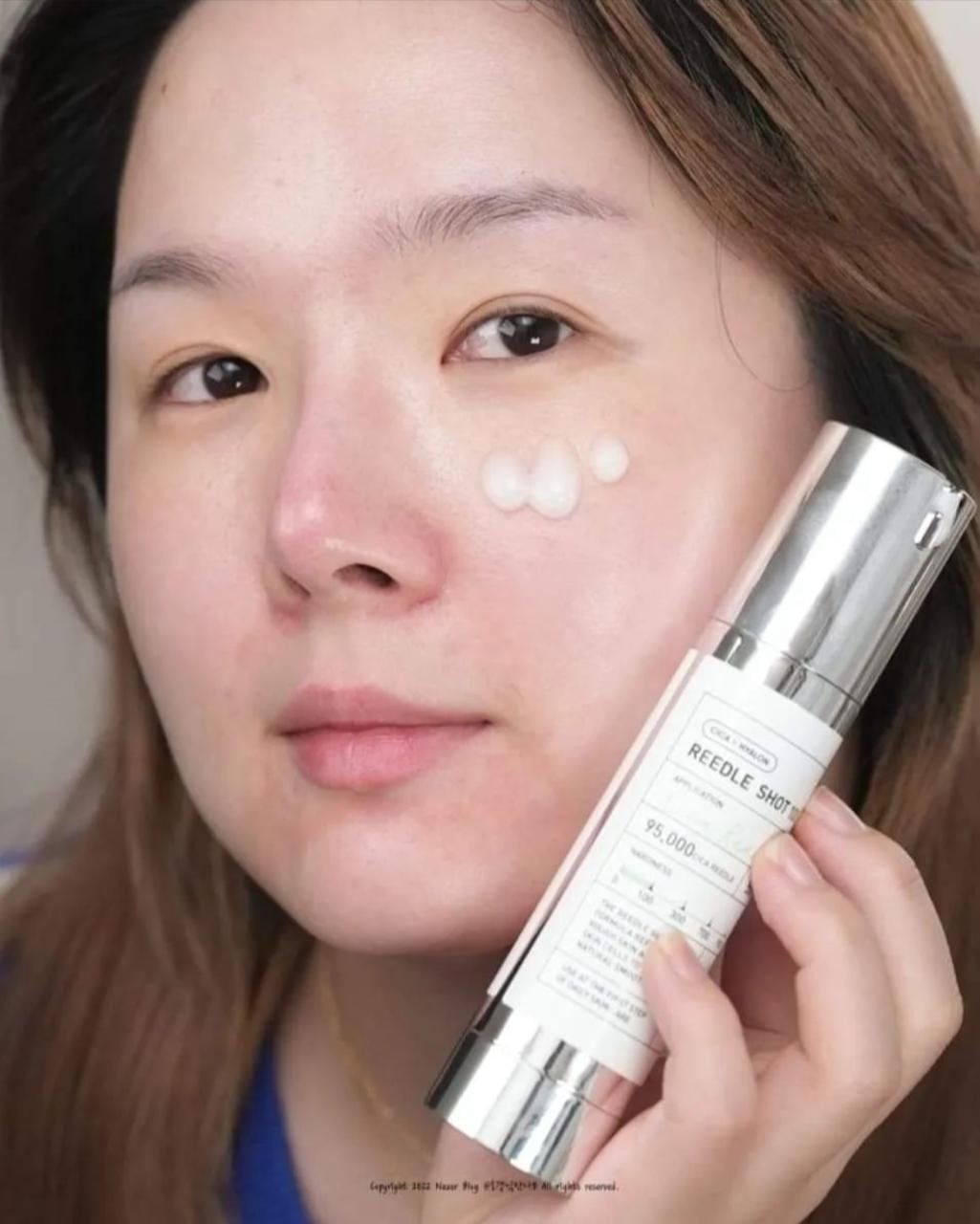 Viral: un influencer español probó una crema coreana con microagujas y su reacción fue impactante