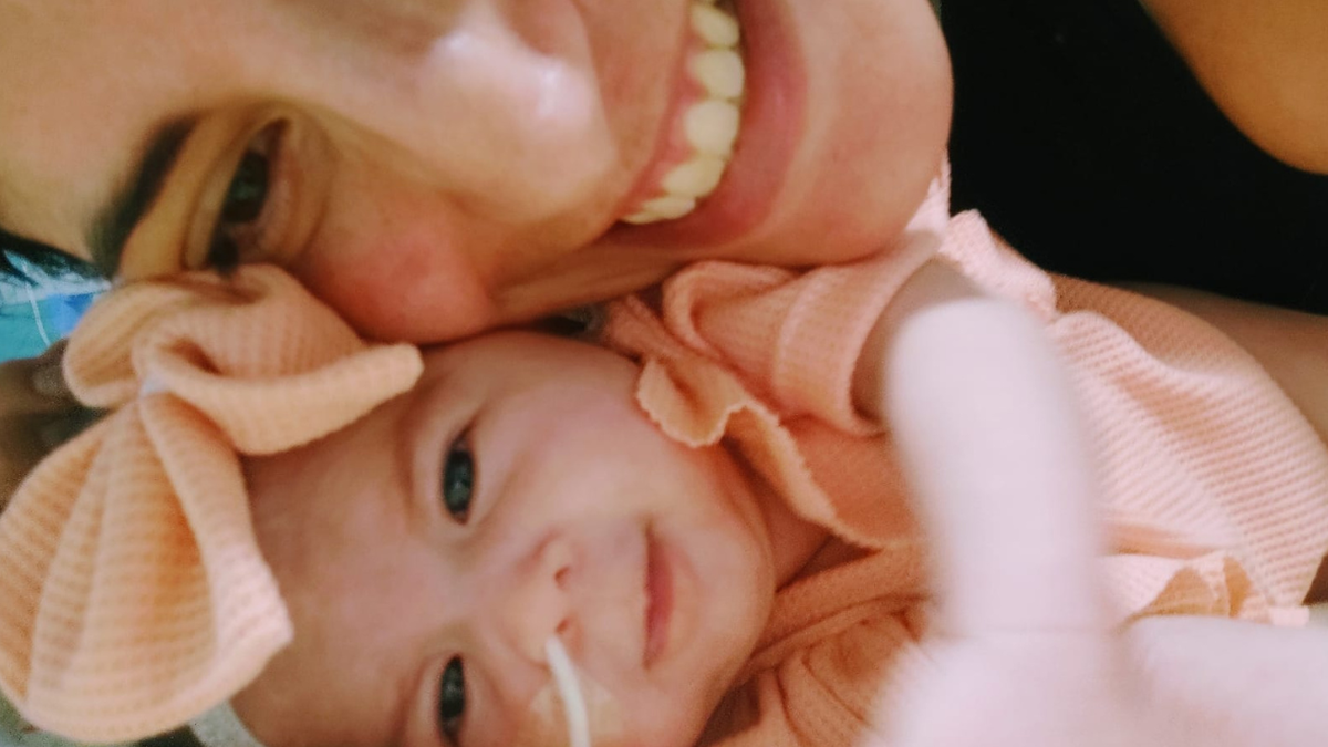 Luna, la bebé mendocina que podrá ser operada gracias a una ola de solidaridad: $10 millones en ...