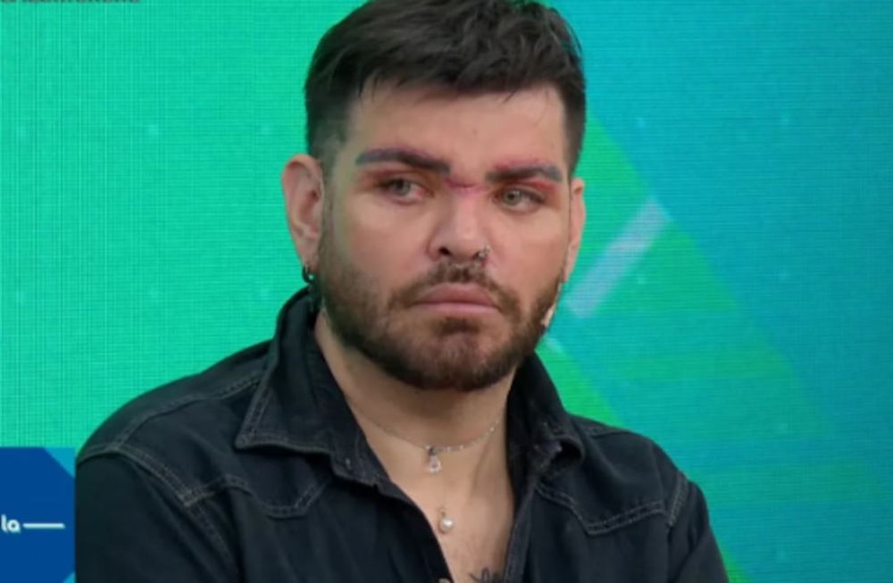 Fran Mariano compartió más detalles del calvario que sufre tras pasar ...