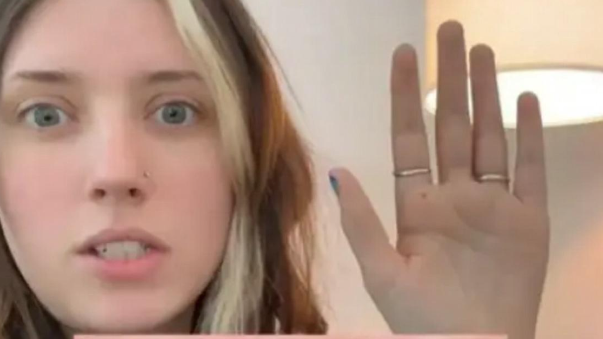 ChatGPT le leyó su mano y en vez de una predicción la derivó al dermatólogo