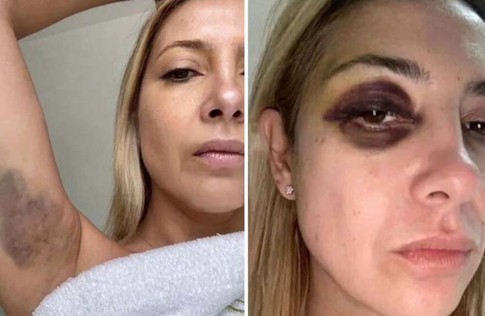 Fabiola Yañez contra Alberto Fernández por violencia de género: pedirán ...