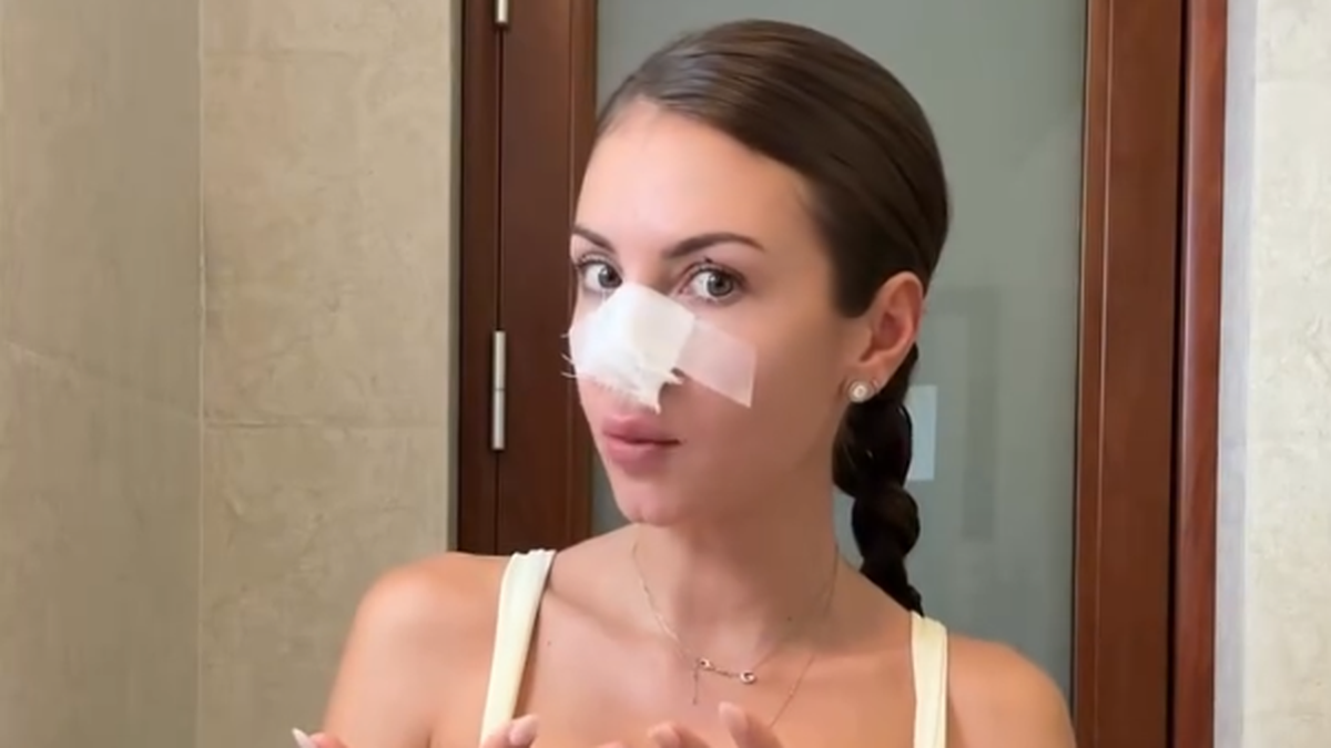 Una influencer terminó en urgencias tras el ataque de su propio gato ...