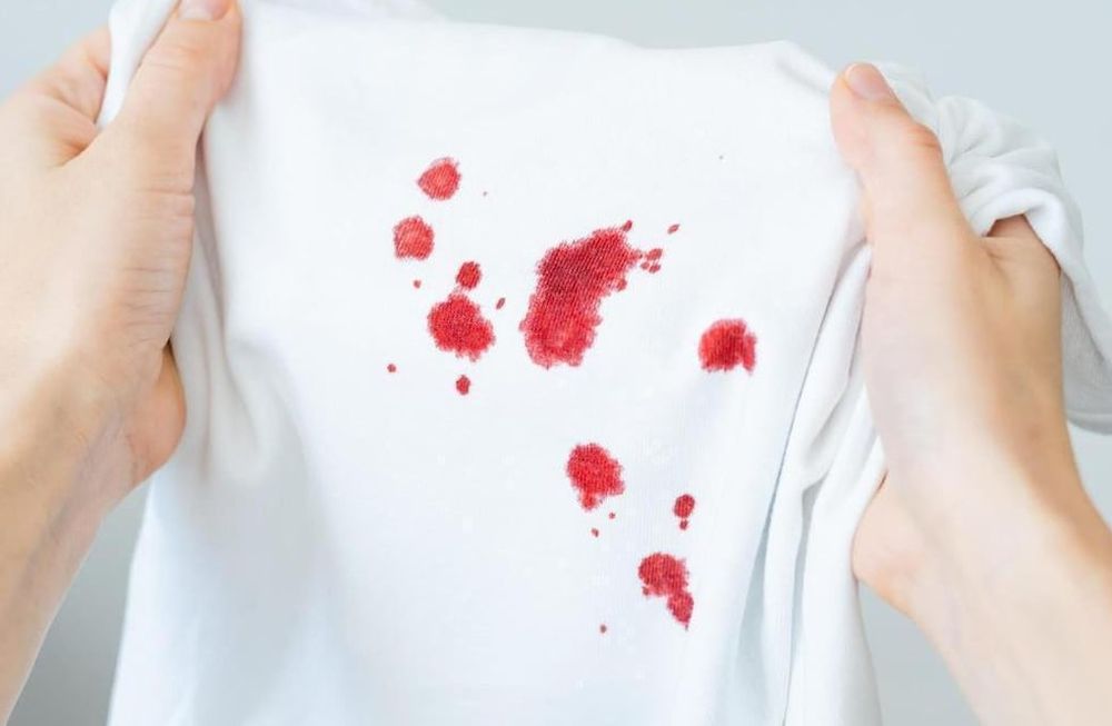 Cuál es la fórmula perfecta para desaparecer los rastros de manchas de ...