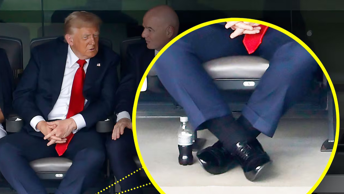 Qué es la insuficiencia venosa crónica, la afección que le diagnosticaron a Donald Trump