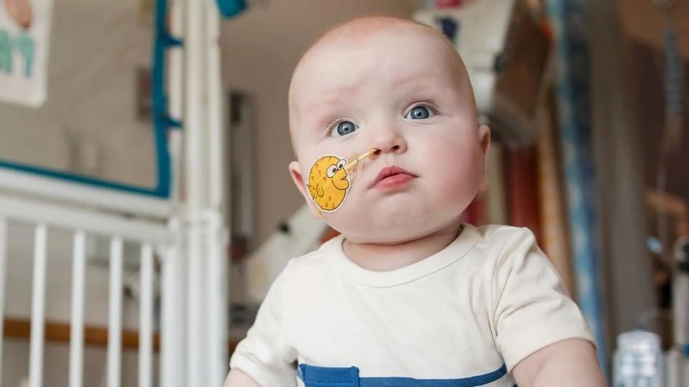Un bebé con una enfermedad metabólica rara fue salvado gracias a la ...