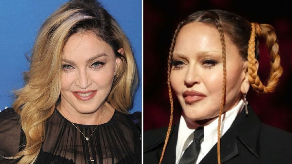 A los 64 años, Madonna se hizo cara nueva y está irreconocible: las ... A los 64 años, Madonna se hizo cara nueva y está irreconocible: las ...