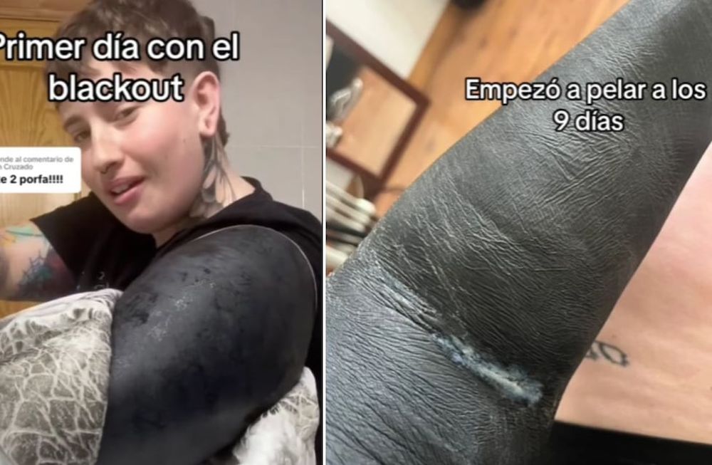 Video: se hizo un tatuaje blackout en todo el brazo, mostró el resultado en TikTok y explotaron ...