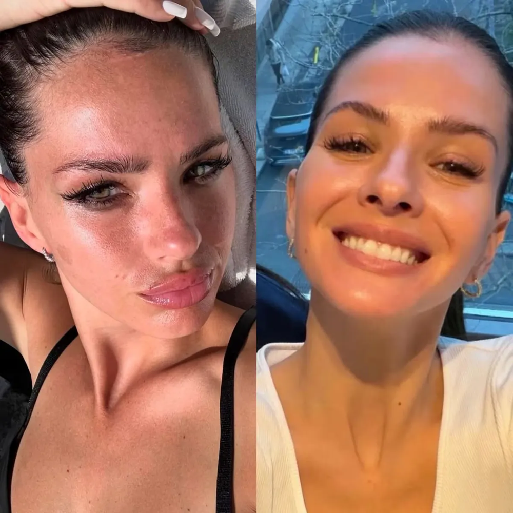 La China Suárez se hizo un tratamiento estético que revela que posee ...