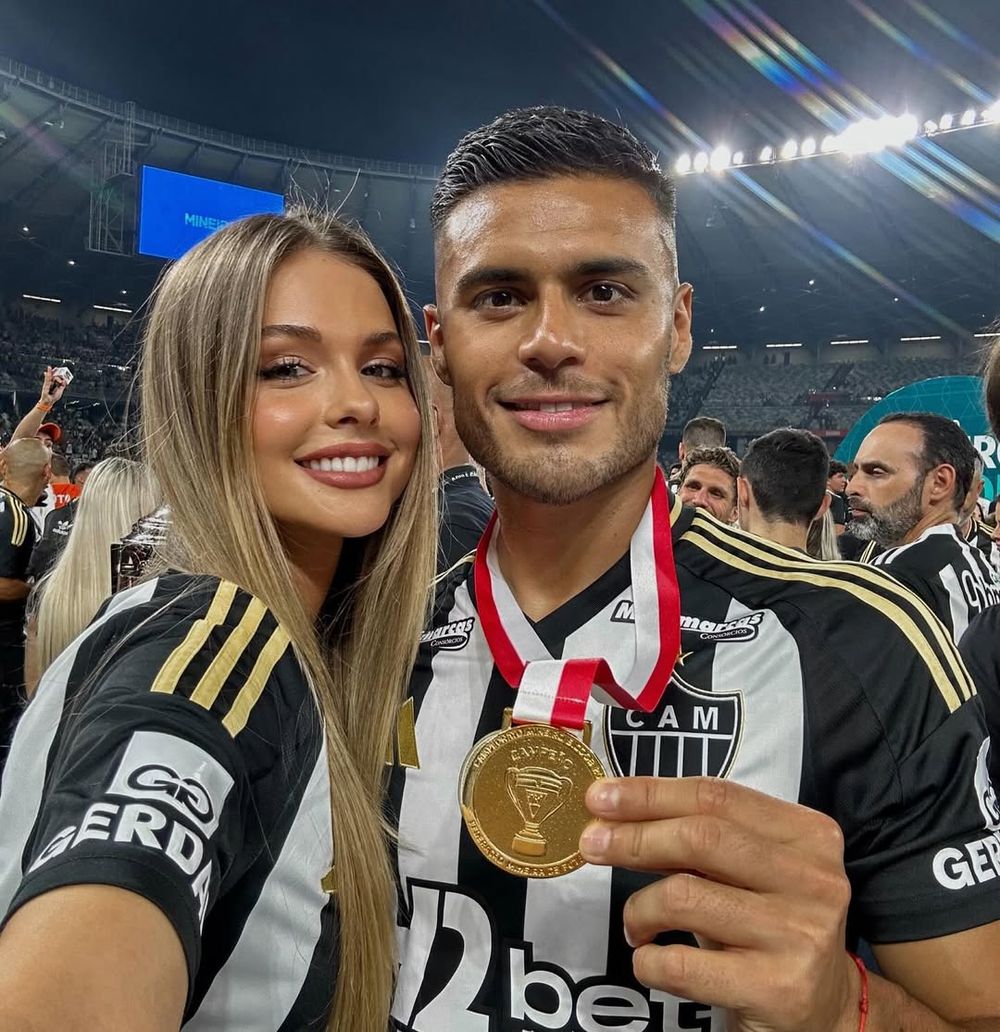 La condición física que padece Aldana Masset, la argentina que podría ...