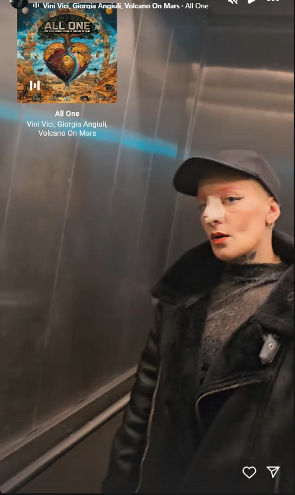 Furia Scaglione tuvo complicaciones con su operación: qué le ocurrió a ...