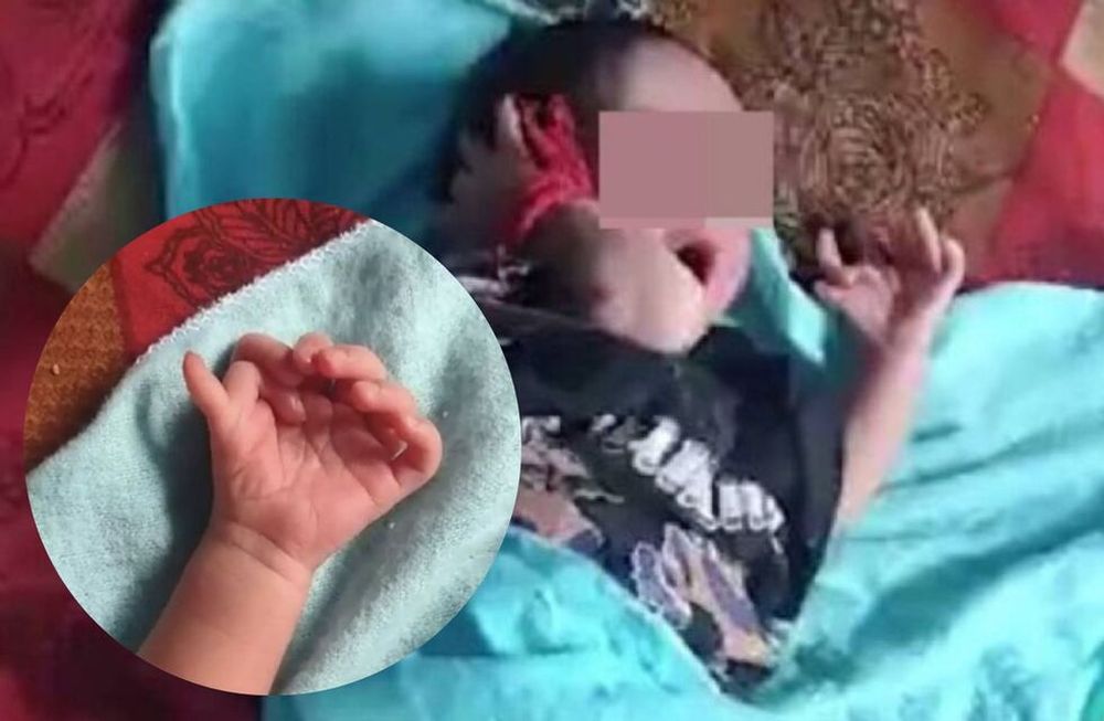 Nació en India un bebé con 26 dedos y afirman que es la “encarnación de ...