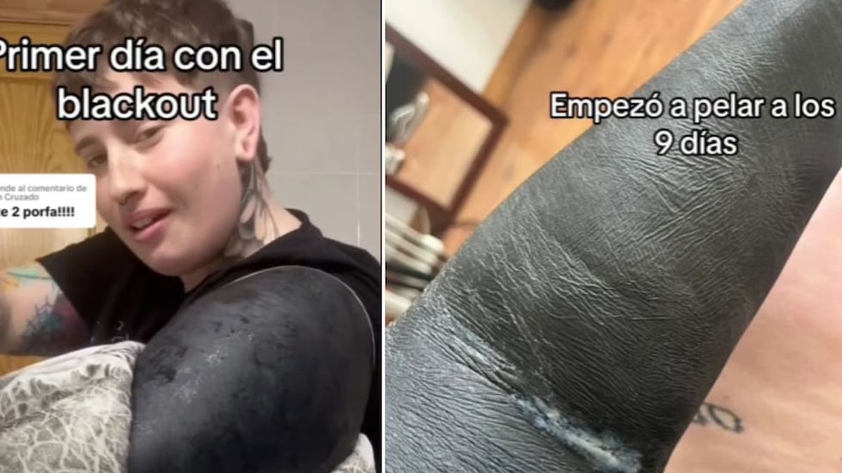 Video: se hizo un tatuaje blackout en todo el brazo, mostró el resultado en TikTok y explotaron ...