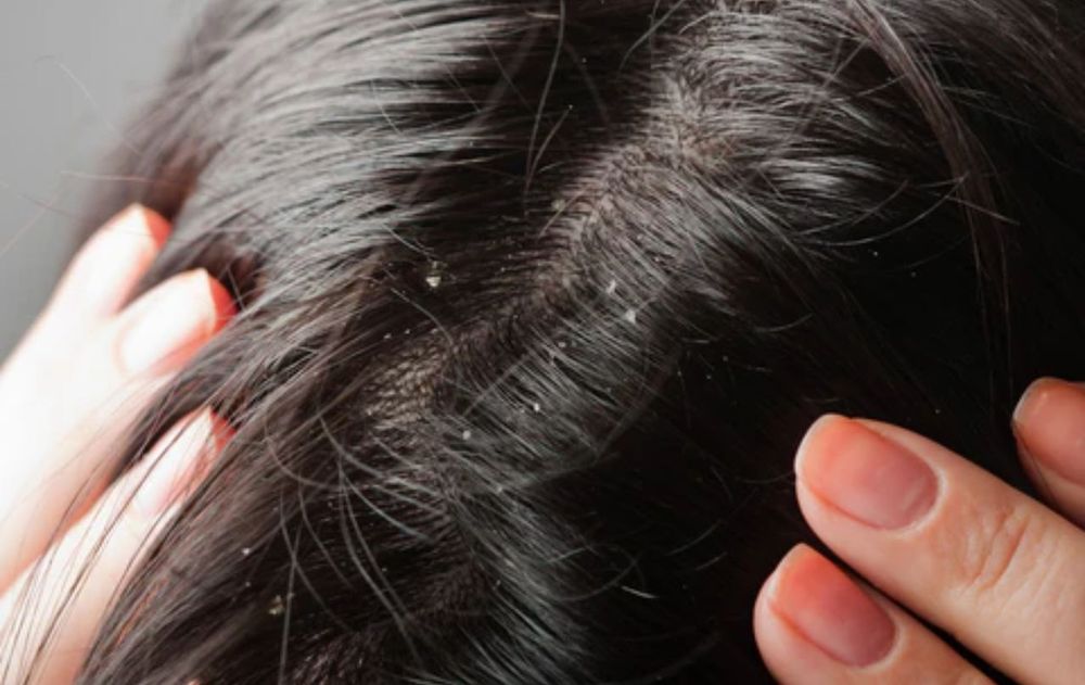 Dormir con el pelo mojado: qué problemas provoca en la salud