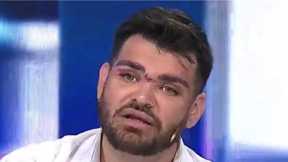 Fran Mariano, ex “Cuestión de Peso”, fue internado de urgencia y ...