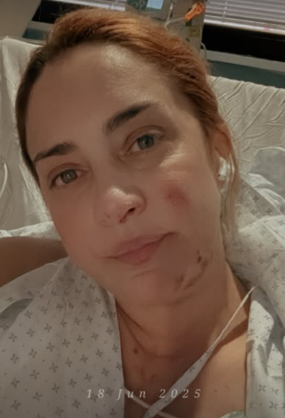Luego del accidente que la dejó internada, María Julia Oliván mostró el ...