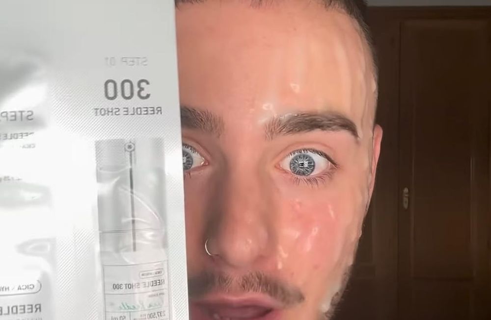 Viral: un influencer español probó una crema coreana con microagujas y ...